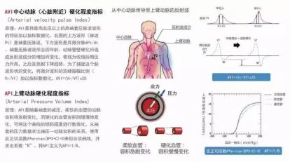 PASESA帕医生动脉硬化检测仪，您的心脑血管健康卫士-搜狐大视野-搜狐新闻