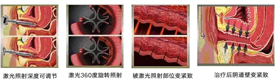 八种急需私密维养的女性,我的小伙伴们竟然都中枪了 搜狐大视野 搜狐新闻