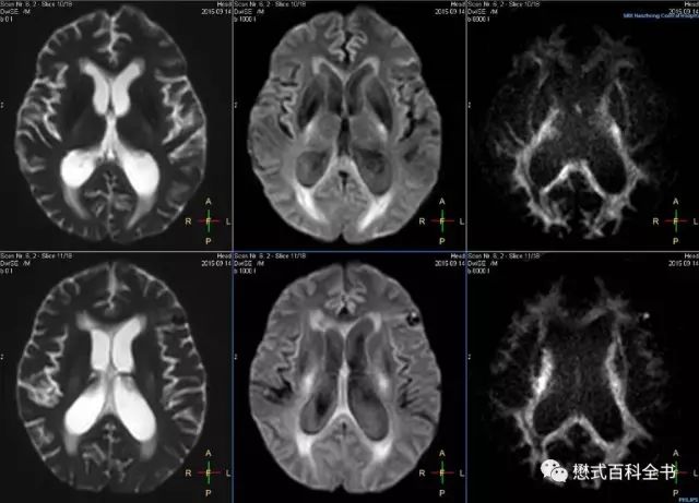 1.5T和3.0T磁共振扫描序列到底有哪些不同？_时间