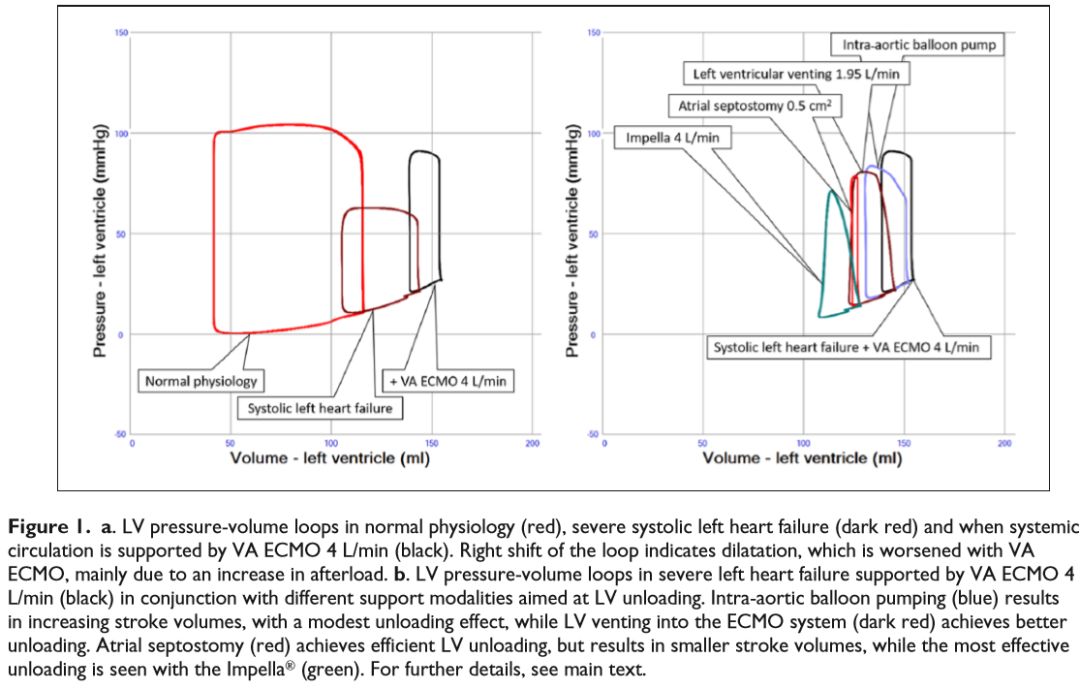 【探讨】VA ECMO期间左心室卸荷：经皮和手术卸荷干预的综述_心脏