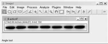 实操讲解基于利用ImageJ软件进行WB条带灰度分析及数据处理_Set
