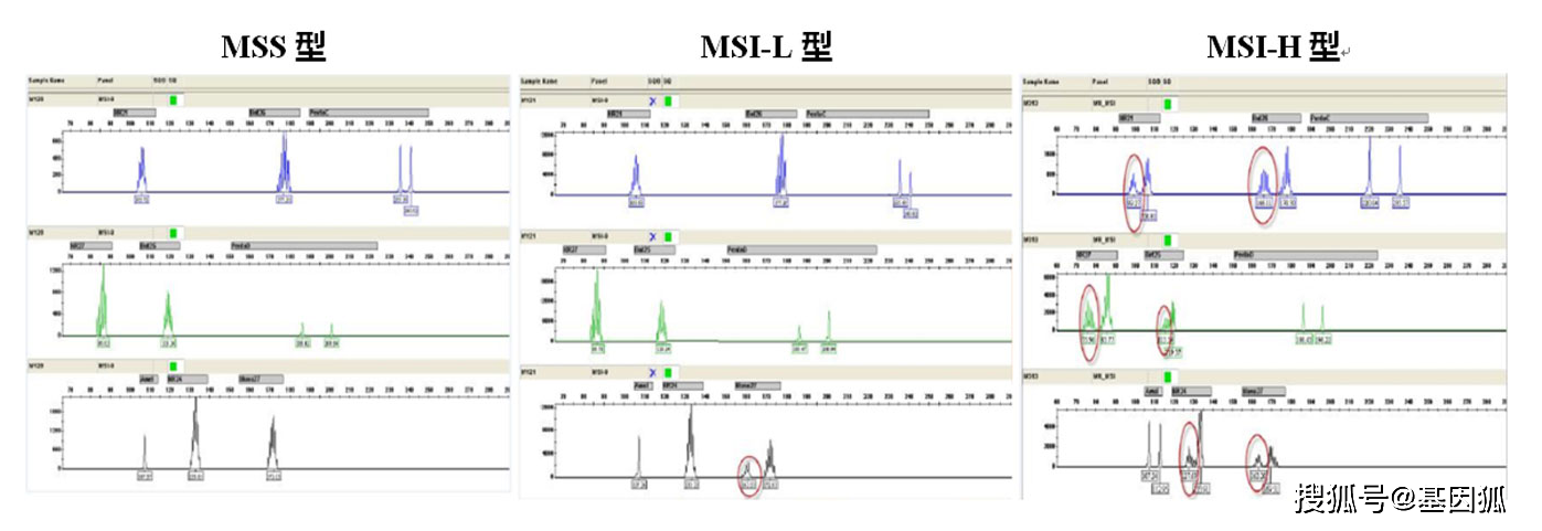科普 | 肿瘤微卫星不稳定性检测新方法（MSIsensor-pro），助力精准医疗_样本