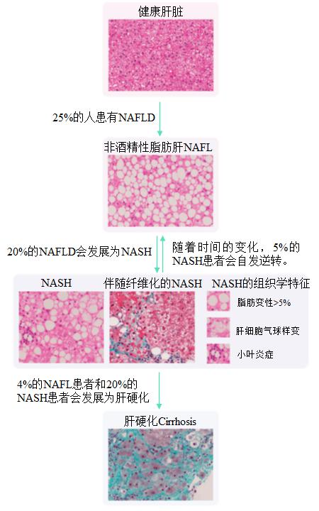Cell Metabolism：胆固醇通过稳定TAZ促进非酒精性脂肪肝炎，或可为NASH治疗干预提供新靶点_研究