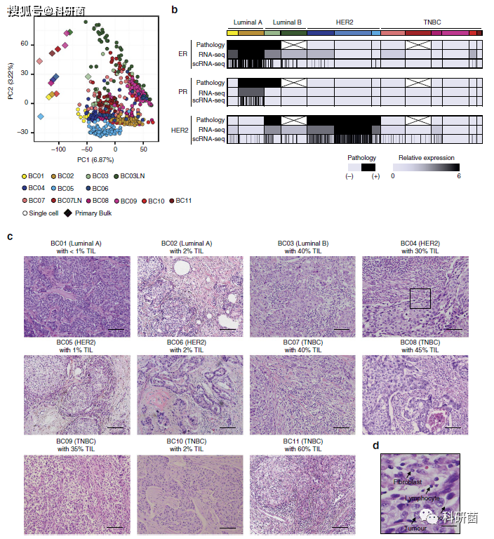 Nat Commun：乳腺癌单细胞测序深度解析_RNA-seq