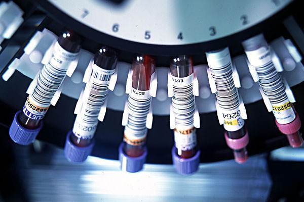 POCT怎么火起来的，检验人基本都知道了吧_检测