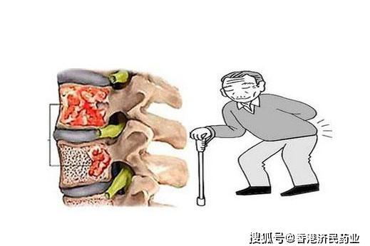 柏马度胺Pomalyst（pomalidomide）治疗多发性骨髓瘤 中文说明书_患者