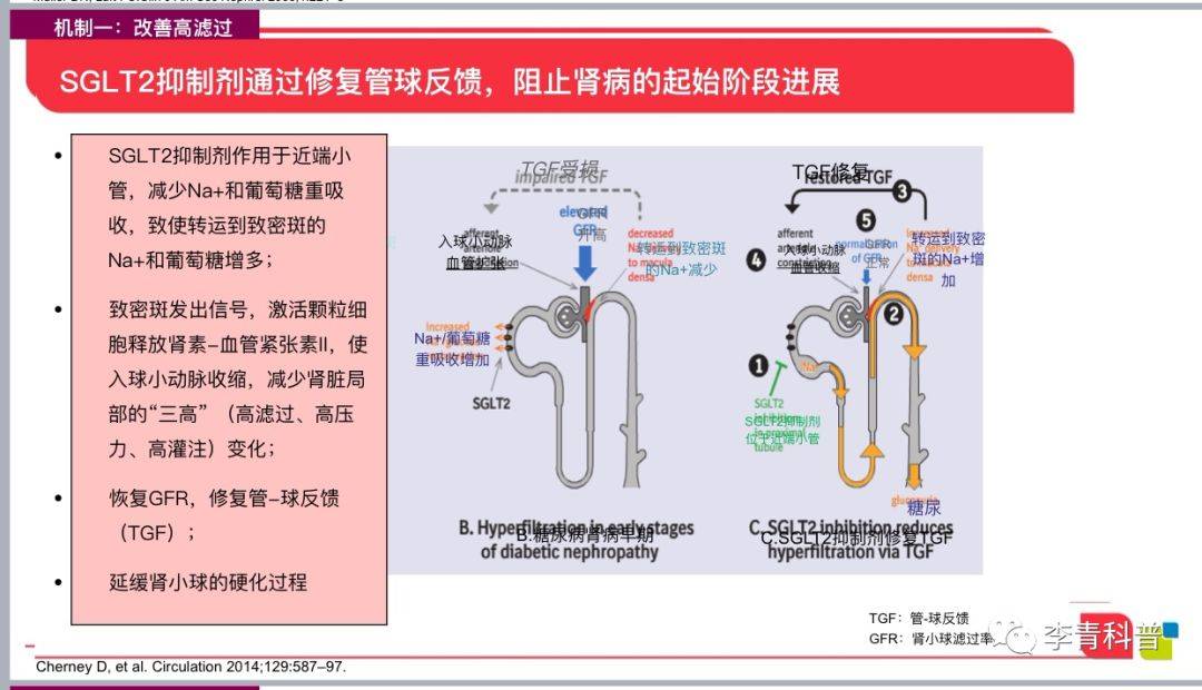 管-球反馈 | SGLT2 抑制剂护肾的主要机制-搜狐大视野-搜狐新闻