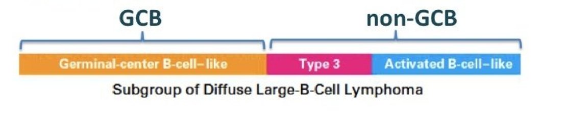 什么是GCB淋巴瘤与non-GCB淋巴瘤？-搜狐大视野-搜狐新闻
