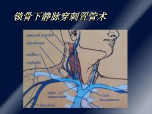 专业解读胃肠癌最常用的一线化疗方案---XELOX（CAPEOX）方案-搜狐大视野-搜狐新闻