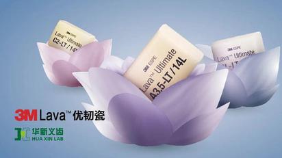 华新新品推荐 丨 Lava™ Ultimate 优韧瓷-高端嵌体的首选-搜狐大视野-搜狐新闻