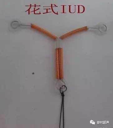 对宫内节育器（IUD），你了解多少？_子宫
