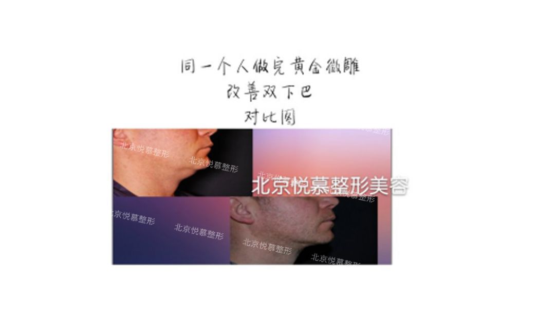 请查阅你的冻龄说明书_皮肤