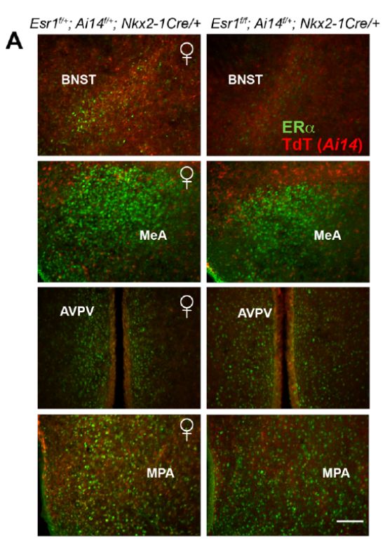 弓状神经核Kiss1神经元雌激素信号抑制一种性别依赖的环路，这种环路可以促进雌性小鼠的骨密度强度 | 文献精读_POMC-Cre
