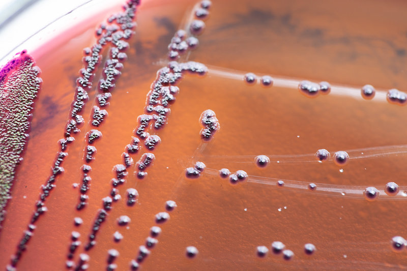 science新文：多药射流泵AcrAB -TolC在细菌获得耐药性的关键作用_研究