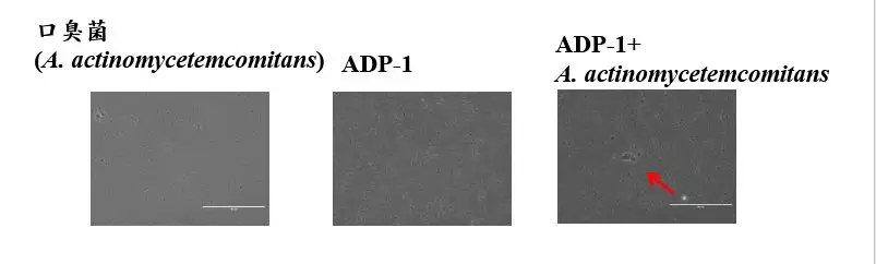 护齿小法宝——ADP-1菌株_口腔