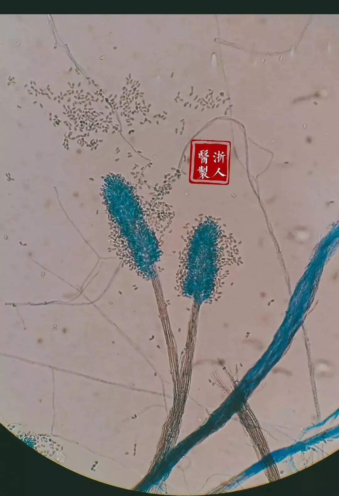 显微镜下的微观世界，你所不知的另一个世界_真菌