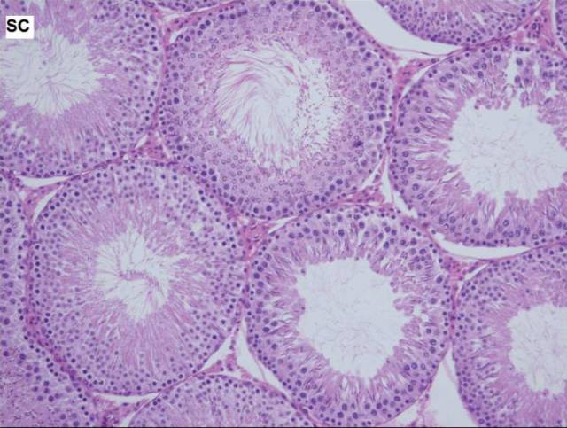 精子的一生~_生殖细胞