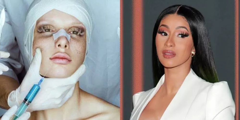 Cardi B 整形失败被副作用折磨，追求美丽真的要保持理性！_身材