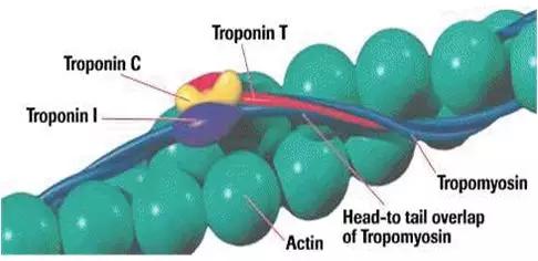 一文看懂cTnI、cTnT和hs-cTn的异同！_检测
