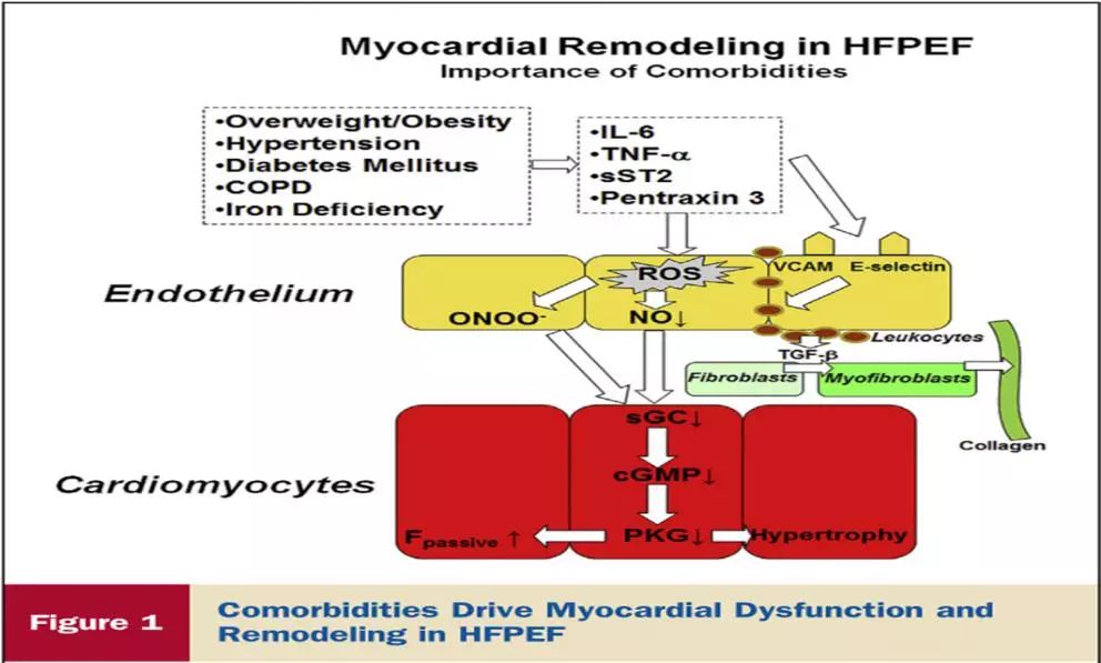 CIHFC2019丨季晓平教授：同一个疾病，不同的类型——HFpEF病生理的异质性_治疗