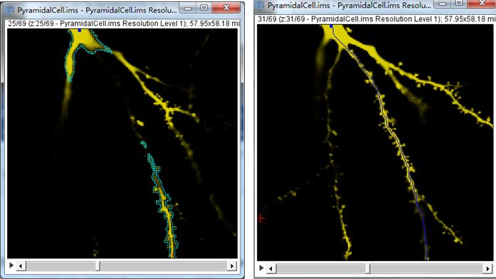 老司机带你解锁ImageJ三维图像分析_Stack