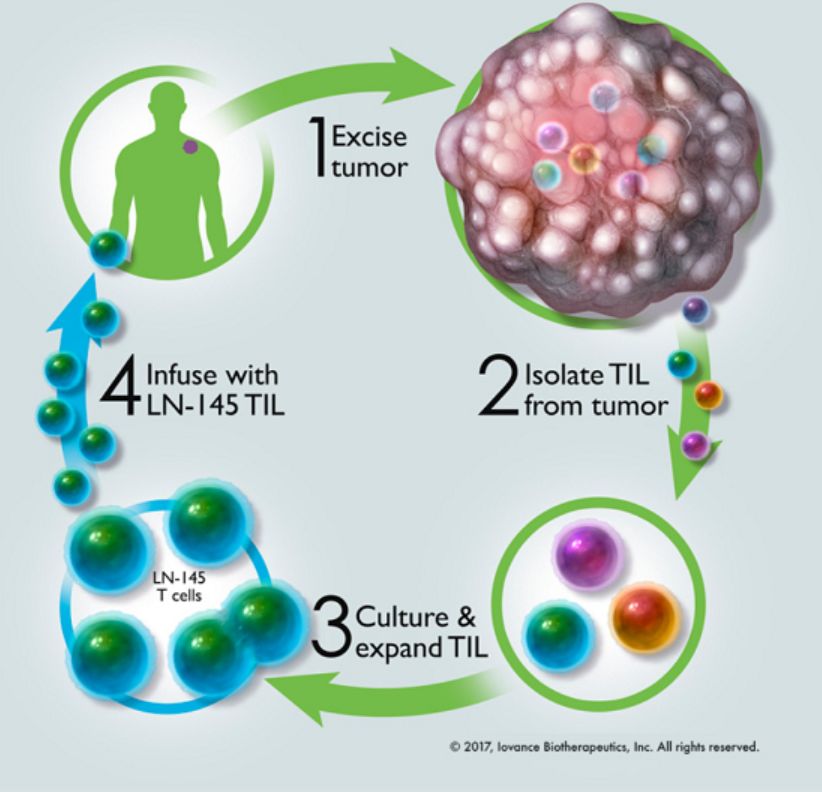 定了！全球首款针对实体瘤的细胞免疫疗法LN-145有望明年获得FDA批准上市！_患者