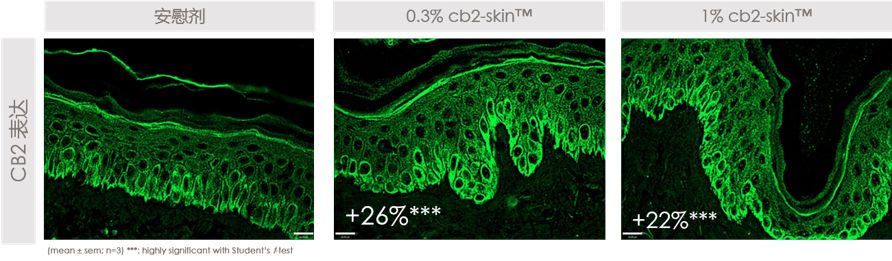 肌肤「读心术」，解忧敏感肌_-skin