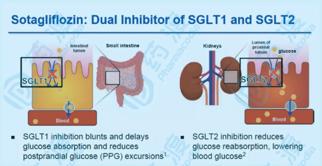 全球糖尿病患者福音!首款SGLT1/SGLT2双效口服降糖药获批上市_葡萄糖