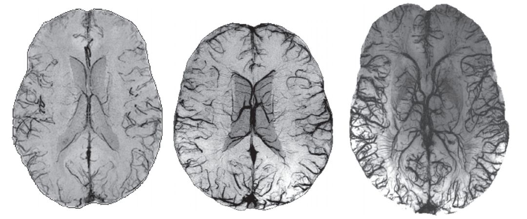 探秘新世界纪录的11.7T磁共振 这些深入思考更值得你注意_成像
