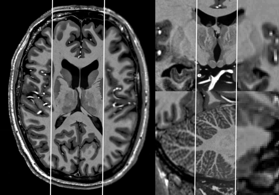 探秘新世界纪录的11.7T磁共振 这些深入思考更值得你注意_成像