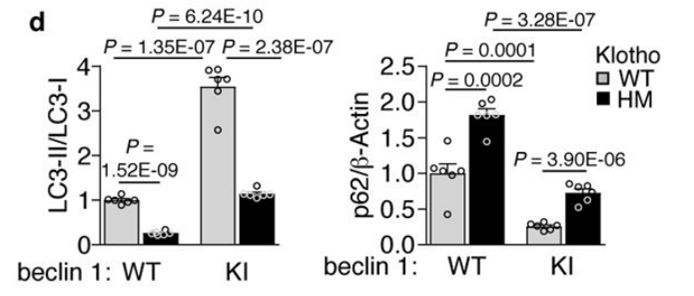 Nature带你走进自噬关键调控蛋白复合物-Beclin 1-搜狐大视野-搜狐新闻