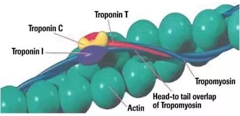 一文看懂cTnI、cTnT和hs-cTn的异同！_检测