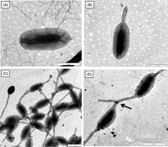 收藏|56张图片带您认识细菌长啥样？_球菌