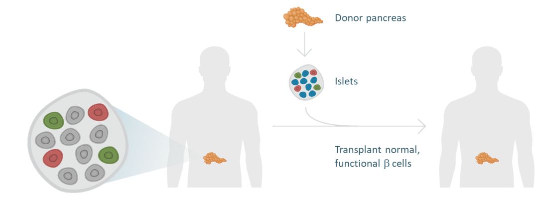 福泰9.5亿美元收购Semma及其干细胞-胰岛B细胞移植疗法_Vertex