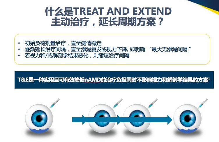 权威专家解读眼底疑难病新进展——DME、nAMD、PCV: 抗VEGF治疗方案应这样选择！_阿柏