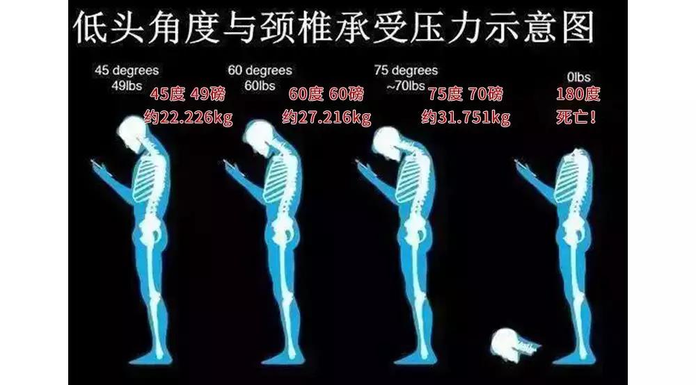 连续24小时低头玩手机，会死吗？？？_脖子