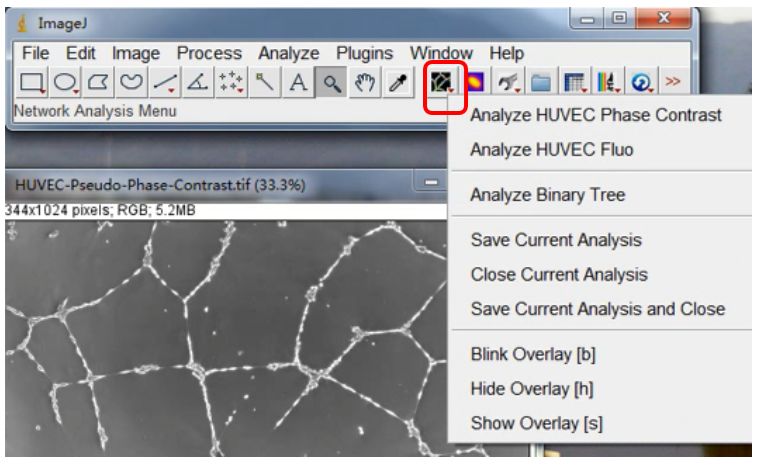 使用ImageJ插件Angiogenesis Analyzer对血管网络进行定量！ – 王进的个人网站