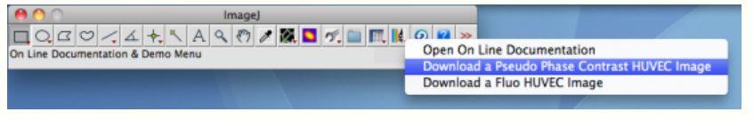 使用ImageJ插件Angiogenesis Analyzer对血管网络进行定量！ – 王进的个人网站