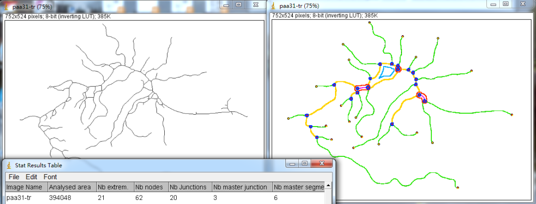 使用ImageJ插件Angiogenesis Analyzer对血管网络进行定量！ – 王进的个人网站