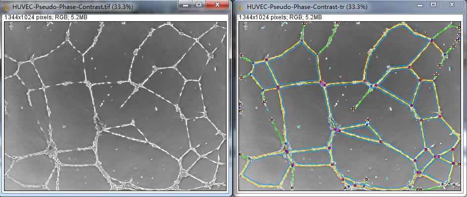 使用ImageJ插件Angiogenesis Analyzer对血管网络进行定量！ – 王进的个人网站