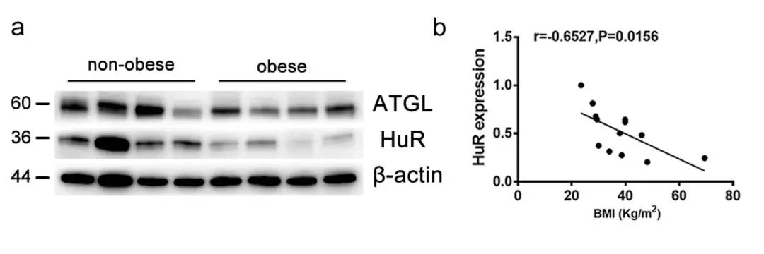 Nature 子刊：山东大学齐鲁医院张文程教授团队发现肥胖治疗新靶点HuR_研究
