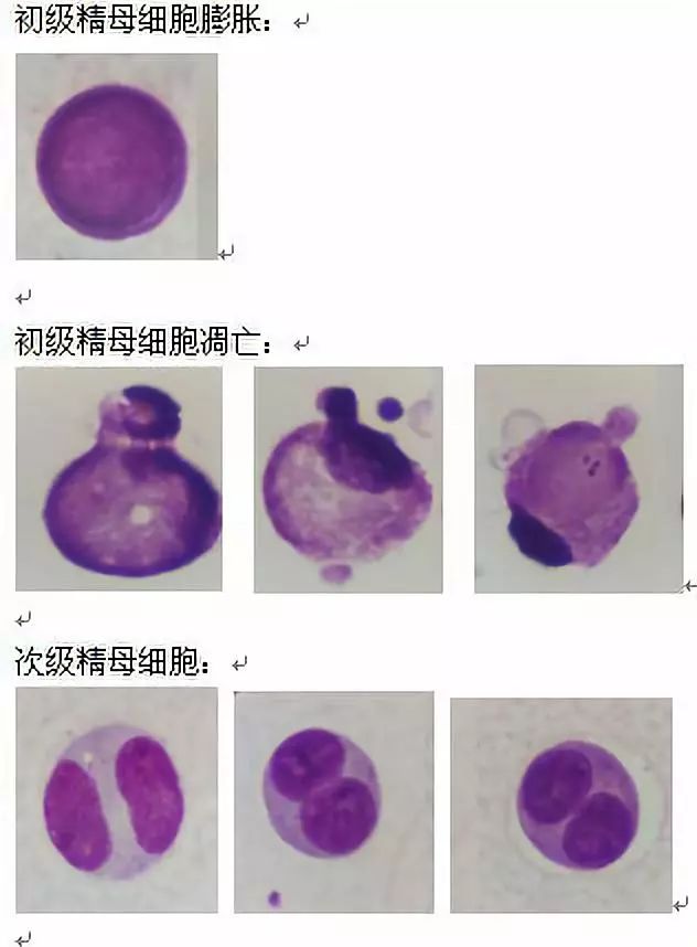 “白细胞”和“生精细胞”傻傻分不清_精子