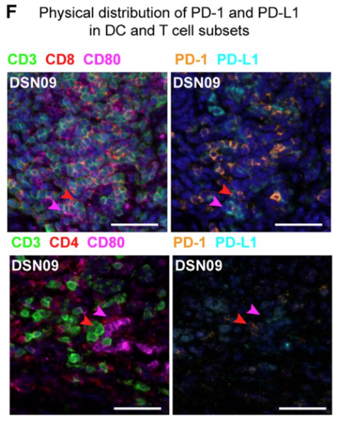 基于单细胞测序研究绘制肝癌中的免疫细胞动态图谱_肿瘤