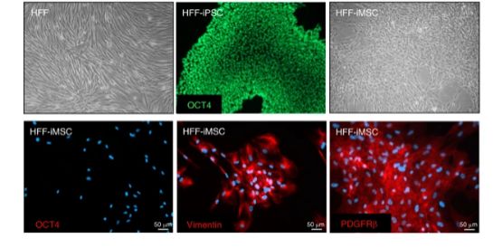 【文献速递】人iPSC衍生的iMSC可改善骨骼再生_分析