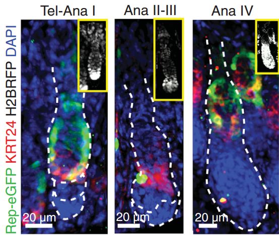 《科学》：淋巴让你难长毛！研究发现毛细淋巴管会让毛囊干细胞「睡觉」，抑制毛发生长，保护干细胞丨科学大发现_bulge