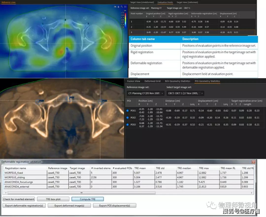 RayStation治疗计划系统综述_China