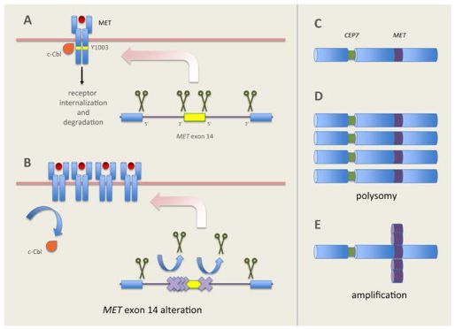 浅谈非小细胞肺癌中MET检测_c-Met