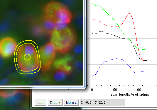重磅分享！那些能快速提升科研效率的imagej实用插件分析 