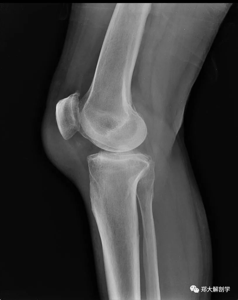 膝盖痛不一定是骨关节炎-搜狐大视野-搜狐新闻