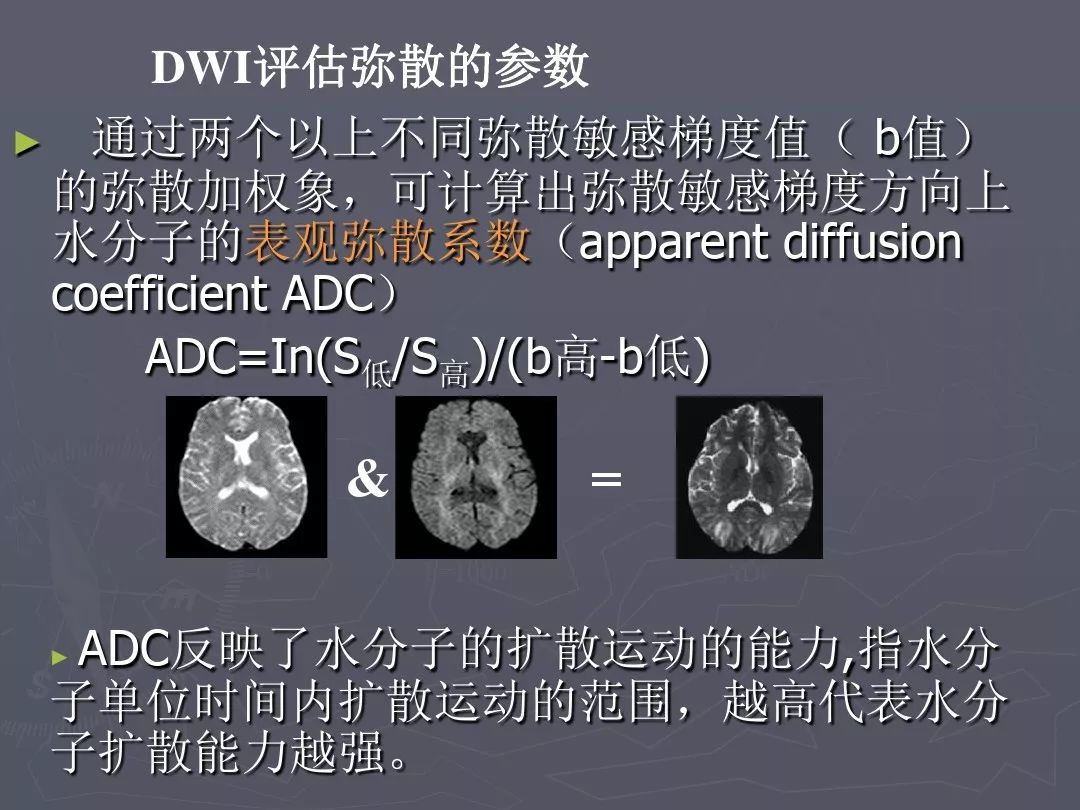 实用课件| DTI原理及在神经外科中的应用